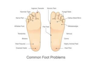 Treating Types of Foot Pain - ART Physical Therapy | Pain Relief